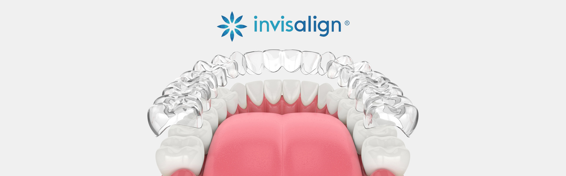 What Are Invisalign Retainers and Why You Need Them